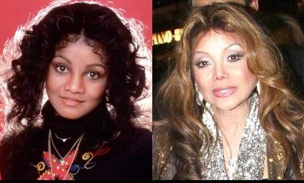 Estes são os resultados de cirurgia plástica em excesso