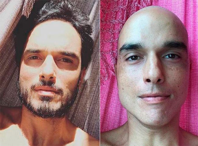 Ator Léo Rosa é diagnosticado com câncer aos 34 anos