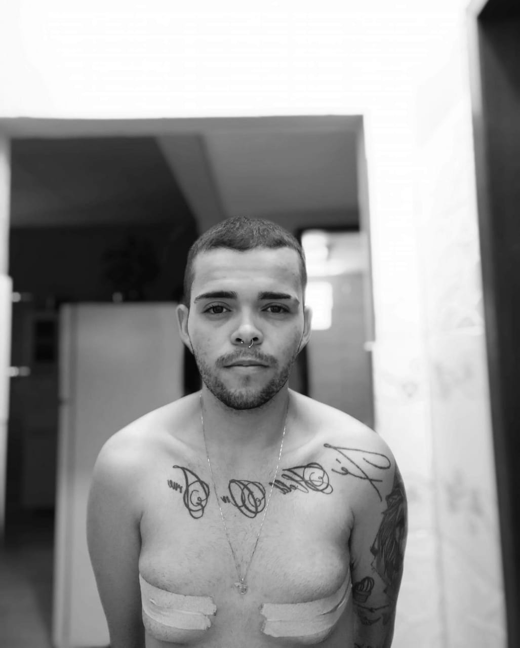 'É uma luta diária', diz trans que criou rifa para mastectomia