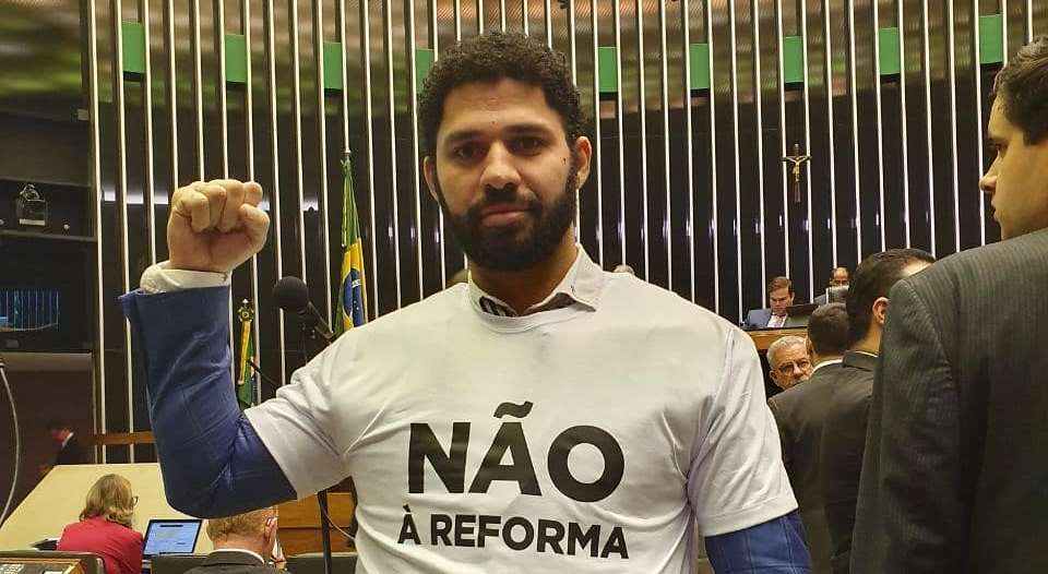 Web suspeita que David Miranda tenha vitiligo ou faça black face