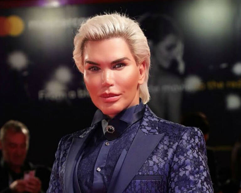 Ken Humano admite que pode perder o nariz após 11ª plástica