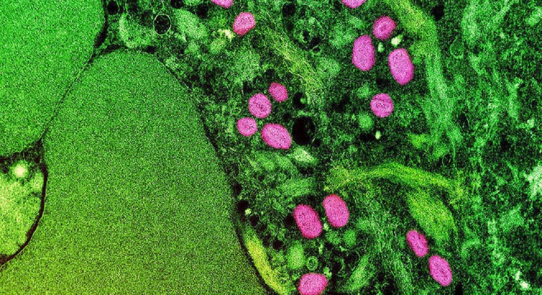 Vírus da varíola do macaco é encontrado no sêmen