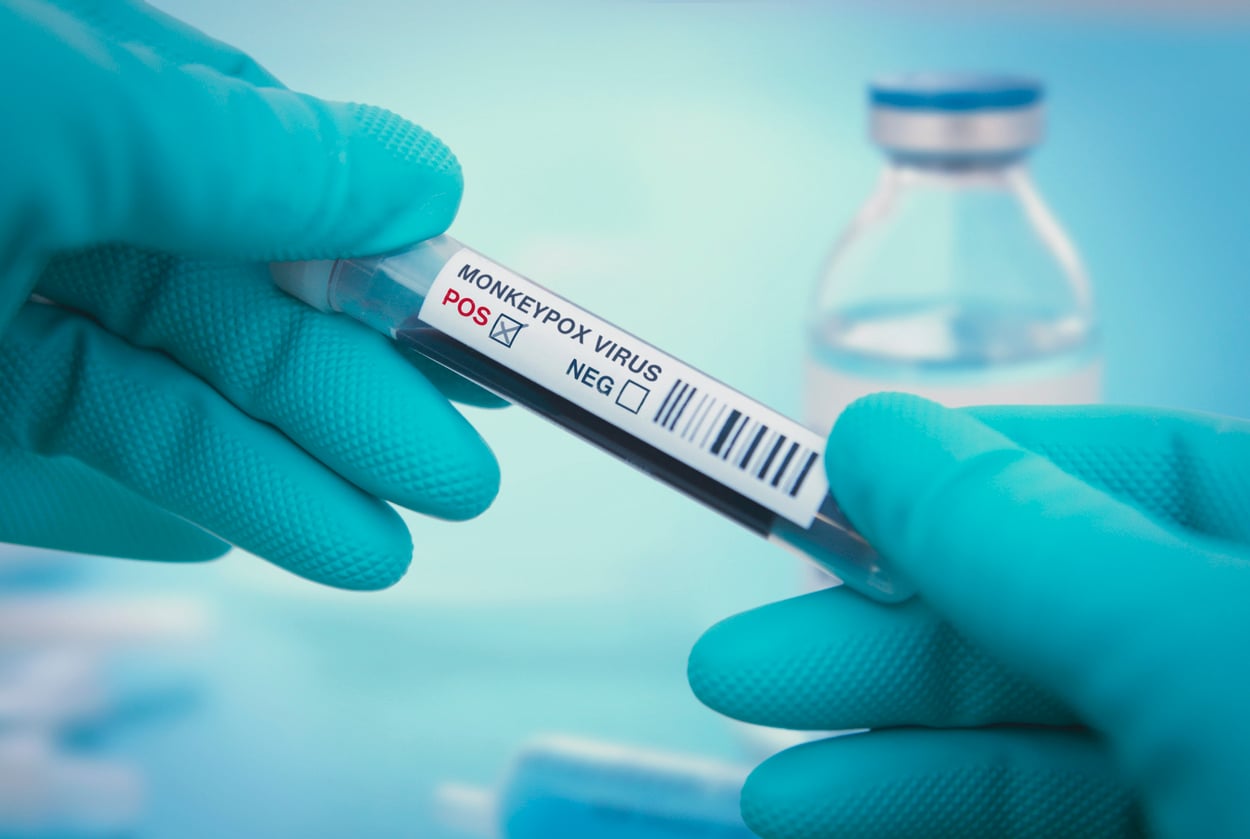 Brasil terá antiviral contra varíola do macaco, segundo Queiroga