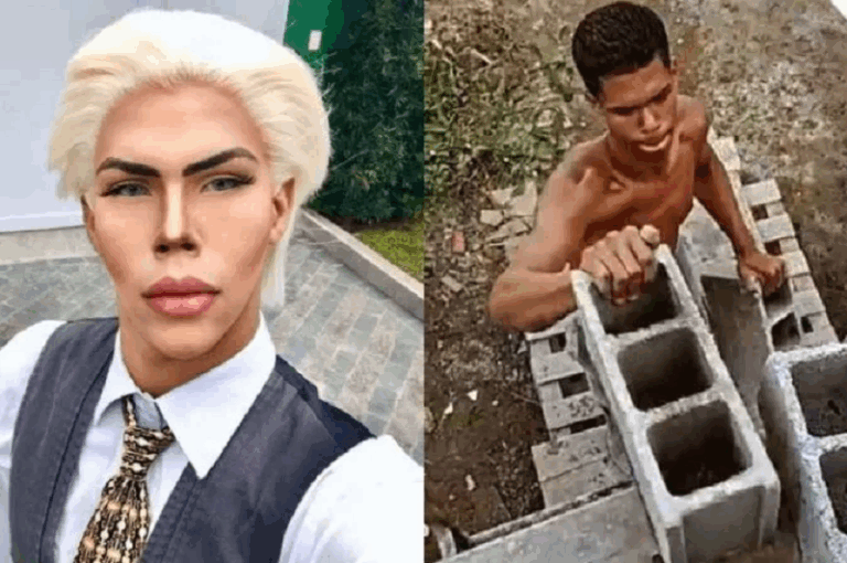 Ex-Ken humano admite distúrbio de imagem após desistir da transformação ...